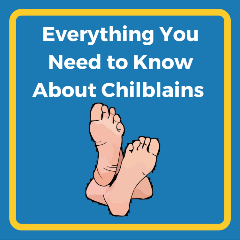 Everything You Need to Know About Chilblains | Heel That Pain